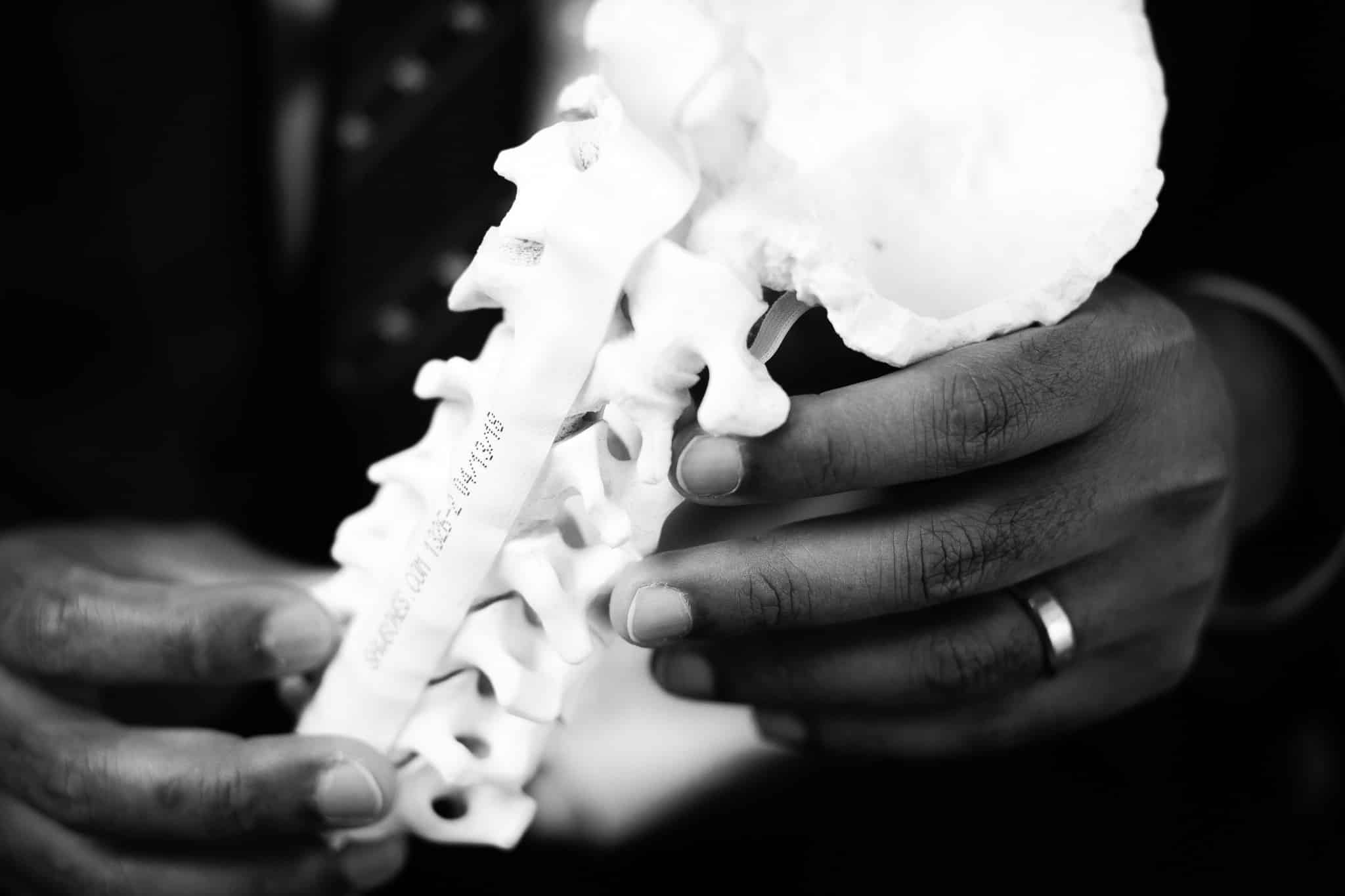 Cervical Disc Herniation | Dr Shiva